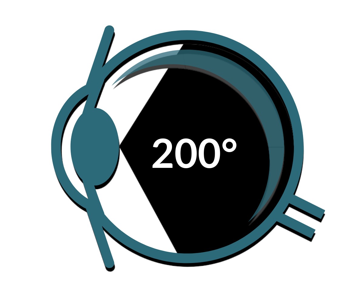Clarus Ultrawide Retinal Exam - Milauskas Eye Institute