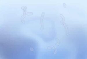 Floaters and Flashes - Milauskas Eye Institute