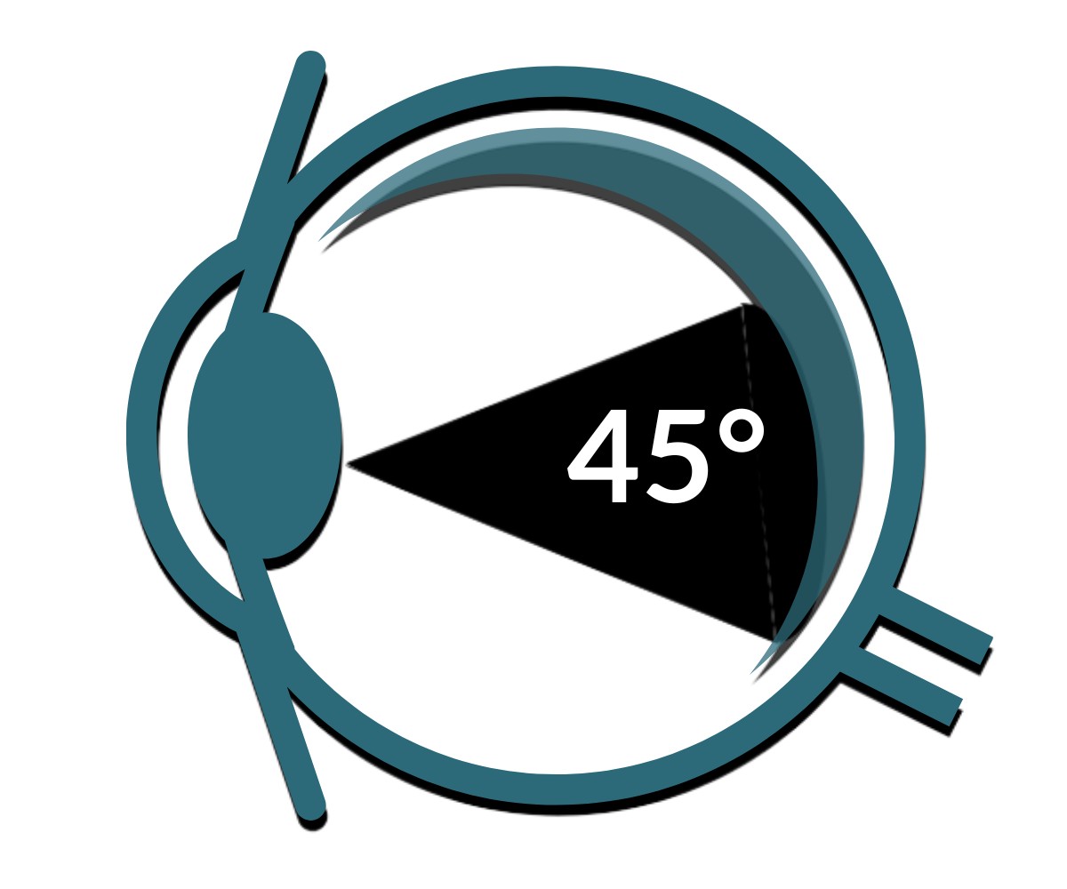Clarus Ultrawide Retinal Exam - Milauskas Eye Institute